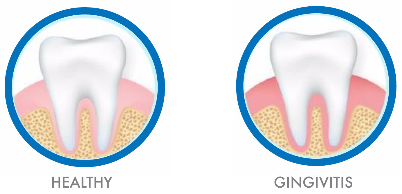 PERIODONTOLOGY – IMPLANTOLOGY ENG – Eversmile
