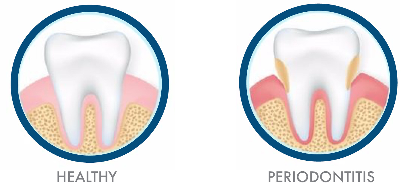 PERIODONTOLOGY – IMPLANTOLOGY ENG – Eversmile